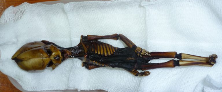 Scientists Discovered New Details About The 'Atacama Alien' Proving It ...
